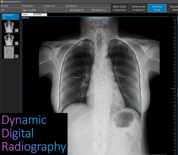 Dynamic Digital Radiology: A New Modality in Action | KM University